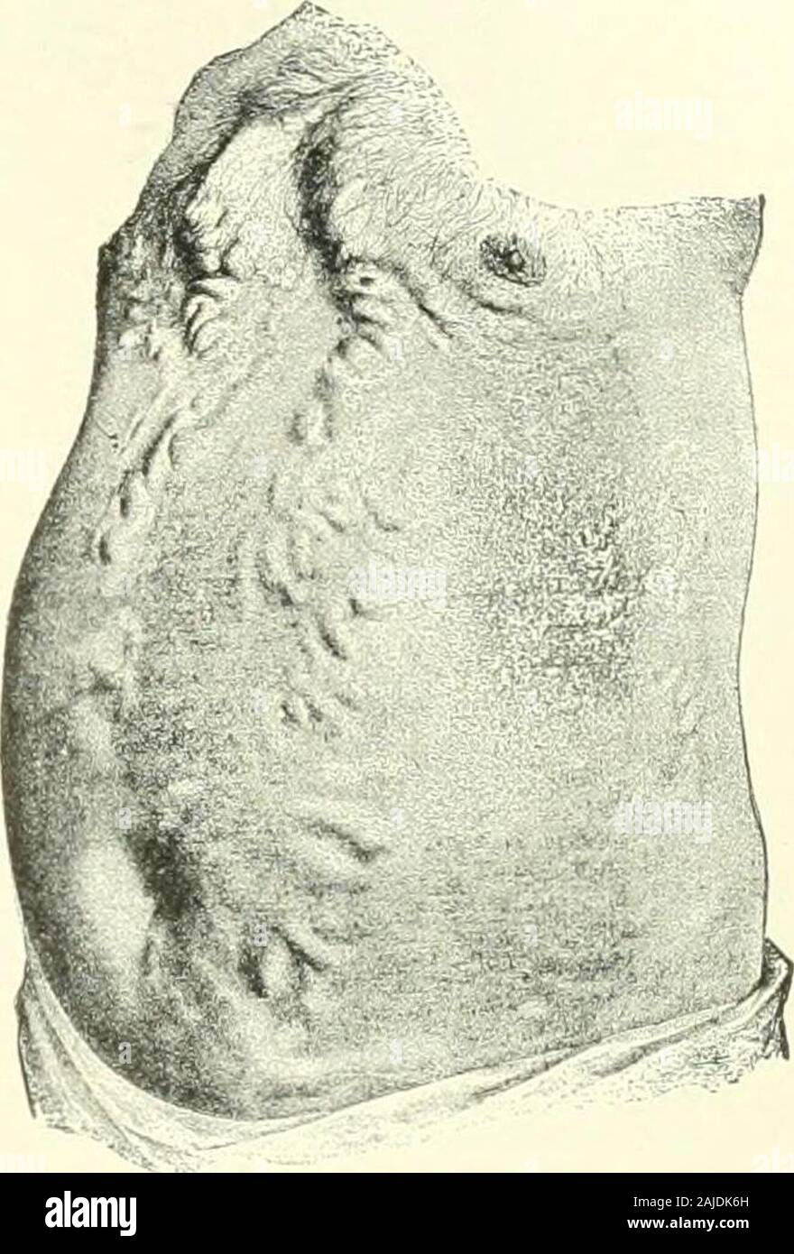 Warty epidermis hi-res stock photography and images - Alamy