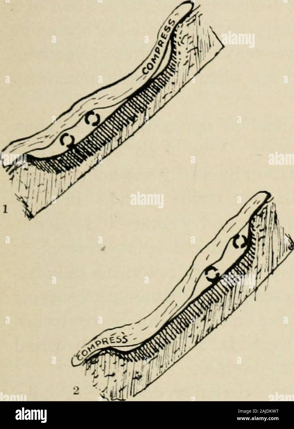 Plastic surgery; its principles and practice . means of a syringe, or ...