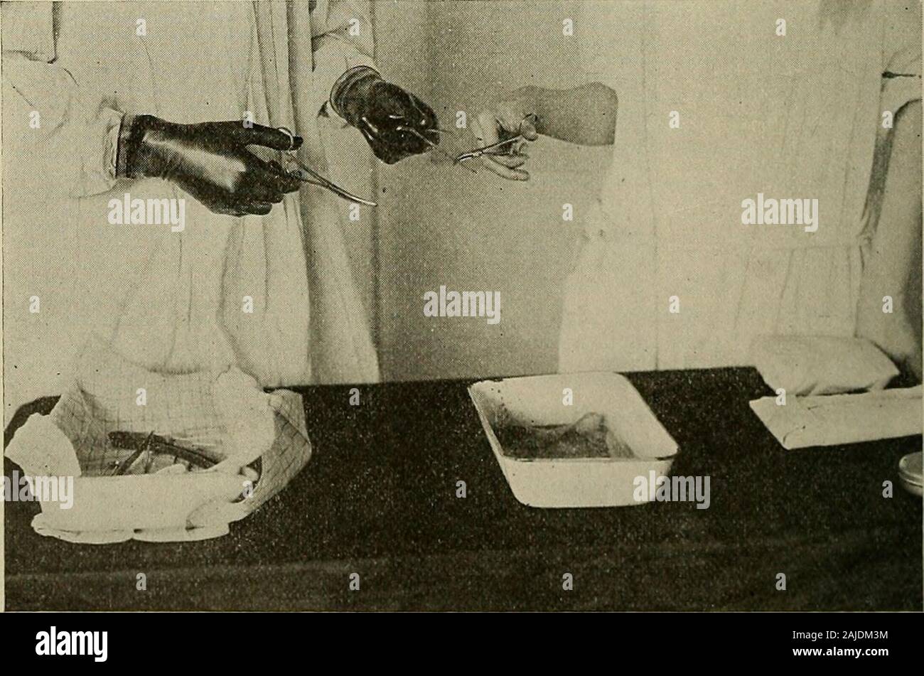 Industrial medicine and surgery . Fig. 129.—Cellulitis of the arm from ...