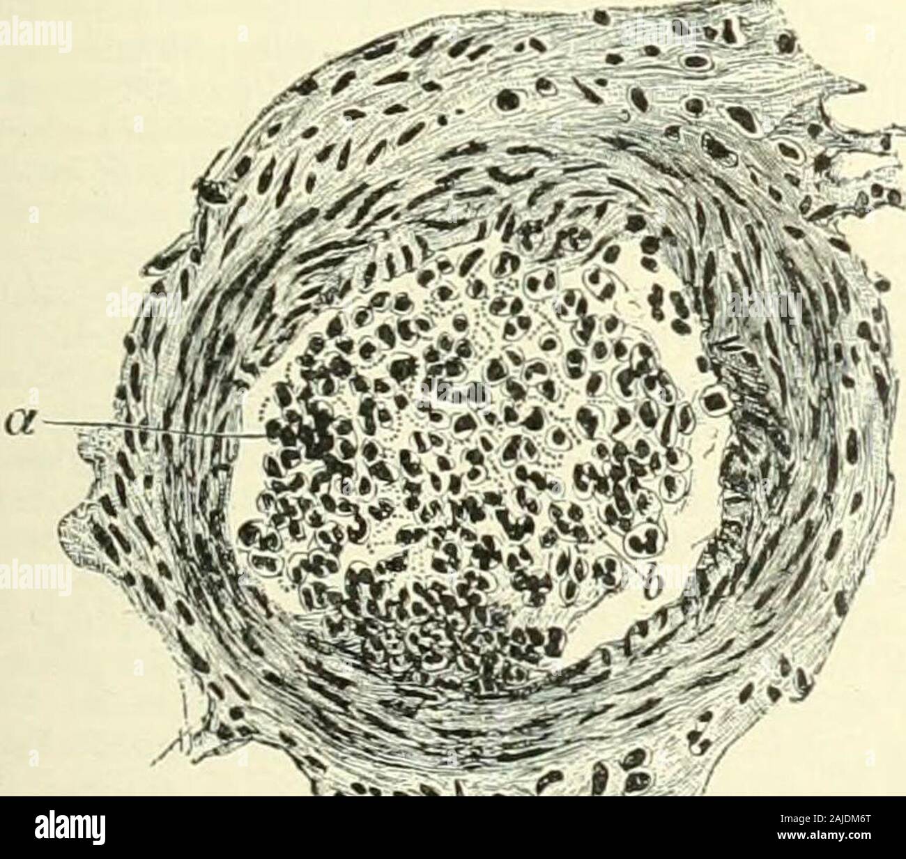 Vasa Vasorum High Resolution Stock Photography and Images - Alamy