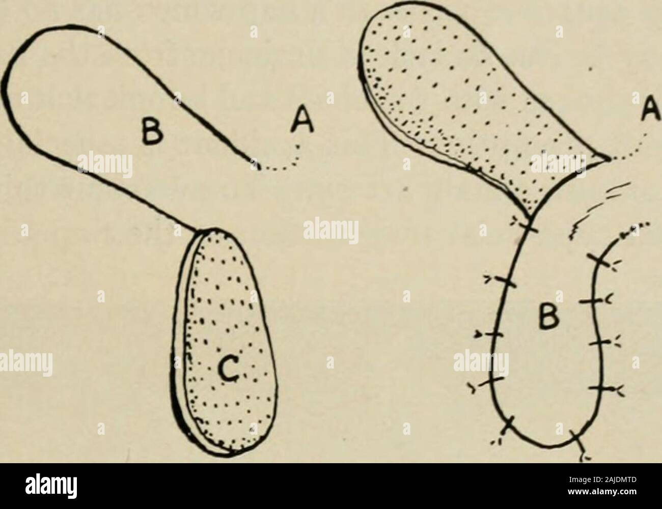 Plastic surgery; its principles and practice . he incisions for raising ...