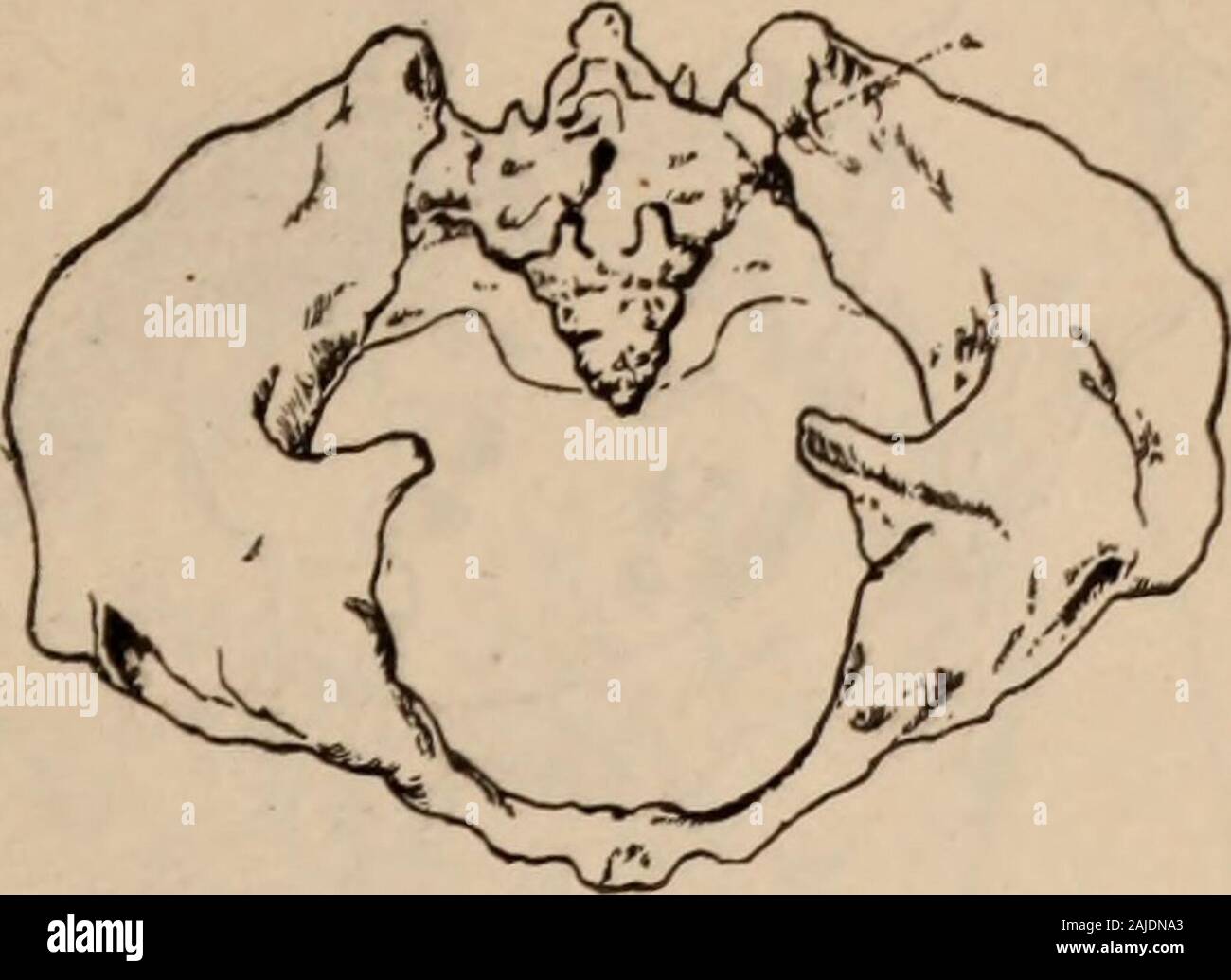 Albany medical annals . Fig. i Pelvis seen from in front. (a ...