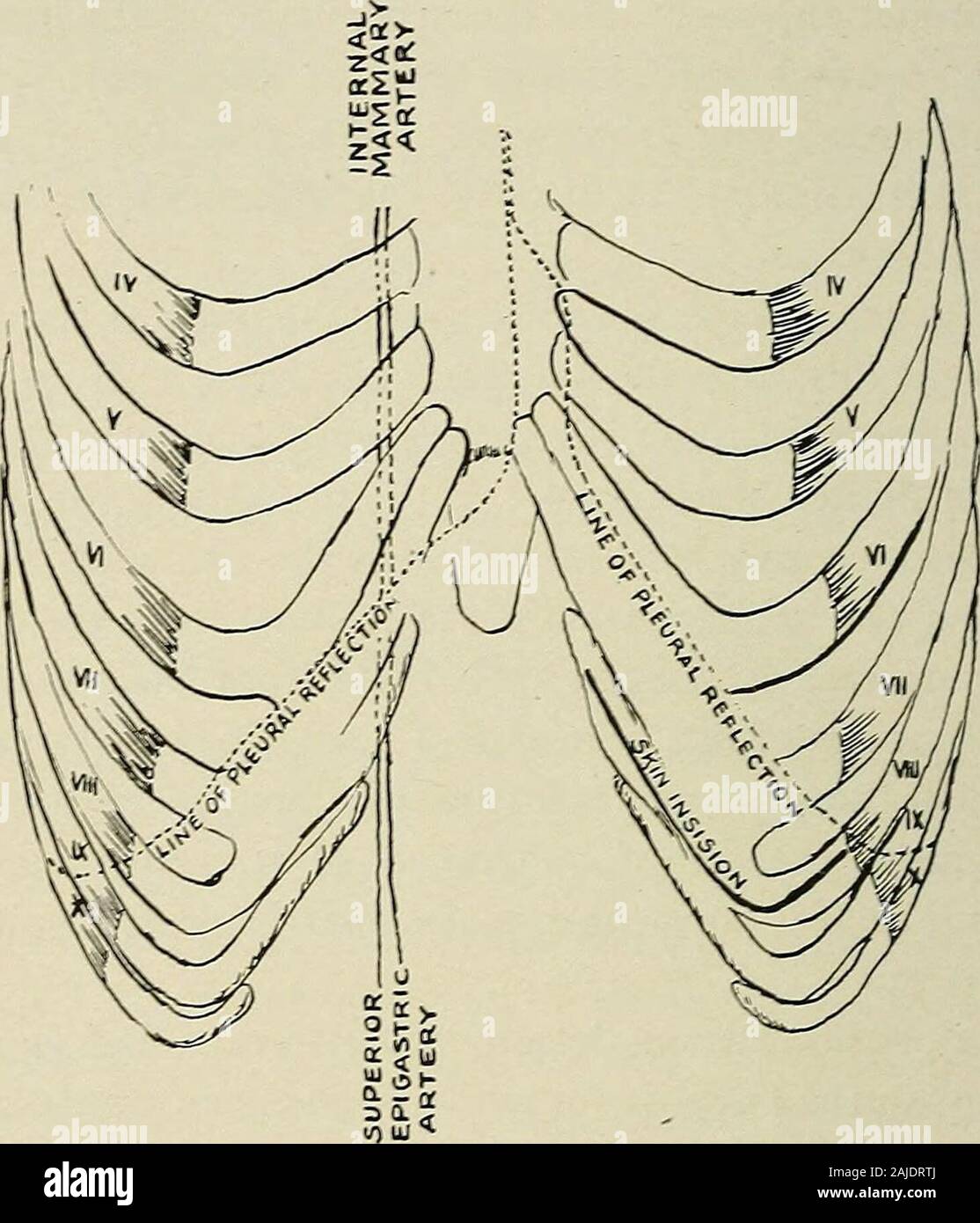 Lines Of Pleural Reflection