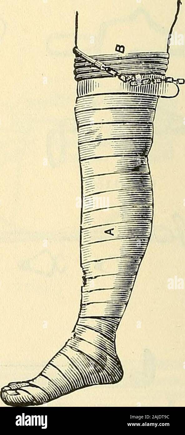 Morton's inhaler hi-res stock photography and images - Alamy