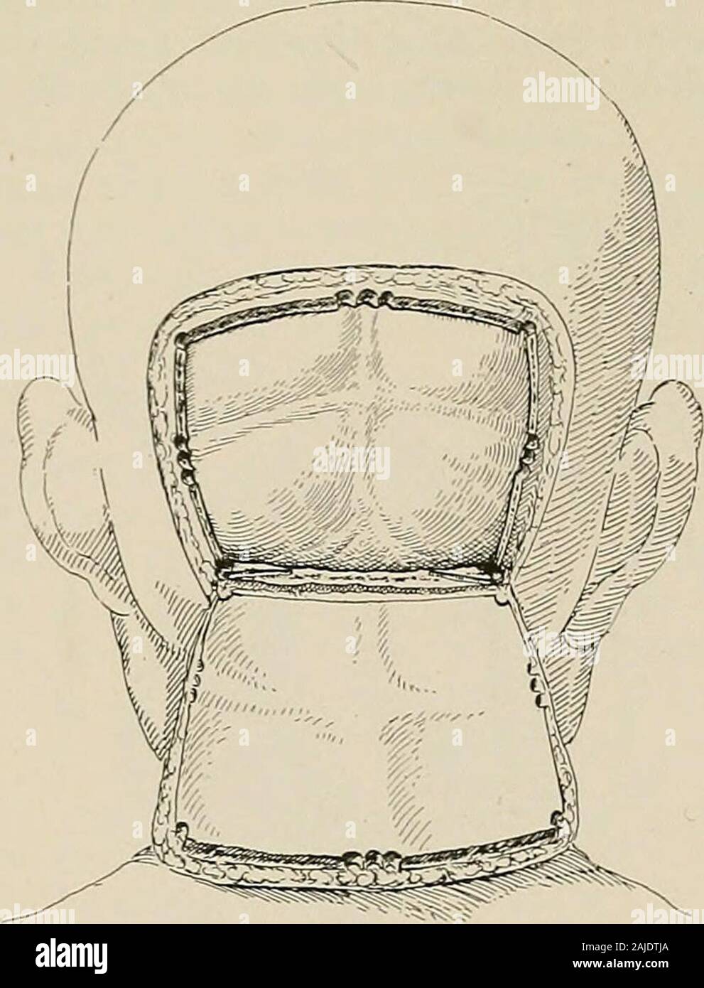 Surgical treatment; a practical treatise on the therapy of surgical ...