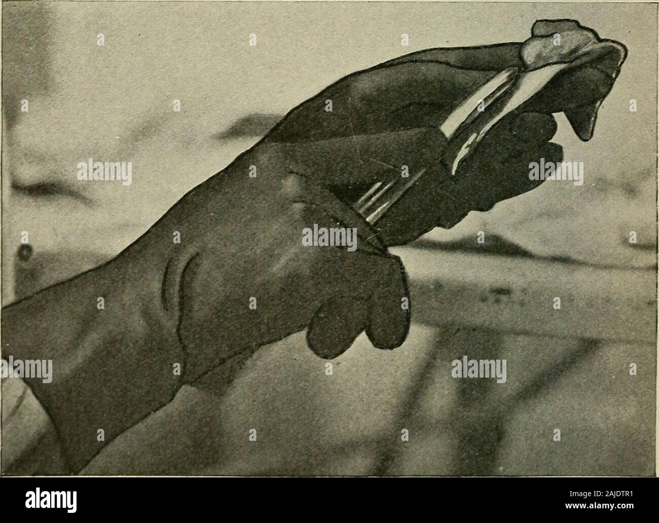 Graft skin plastic surgery hi-res stock photography and images - Alamy