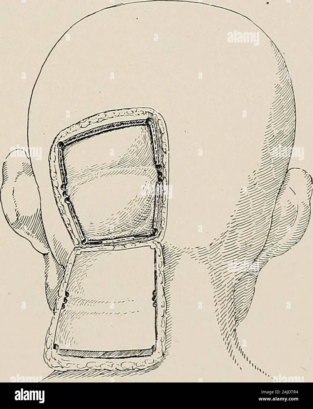 Surgical treatment; a practical treatise on the therapy of surgical ...