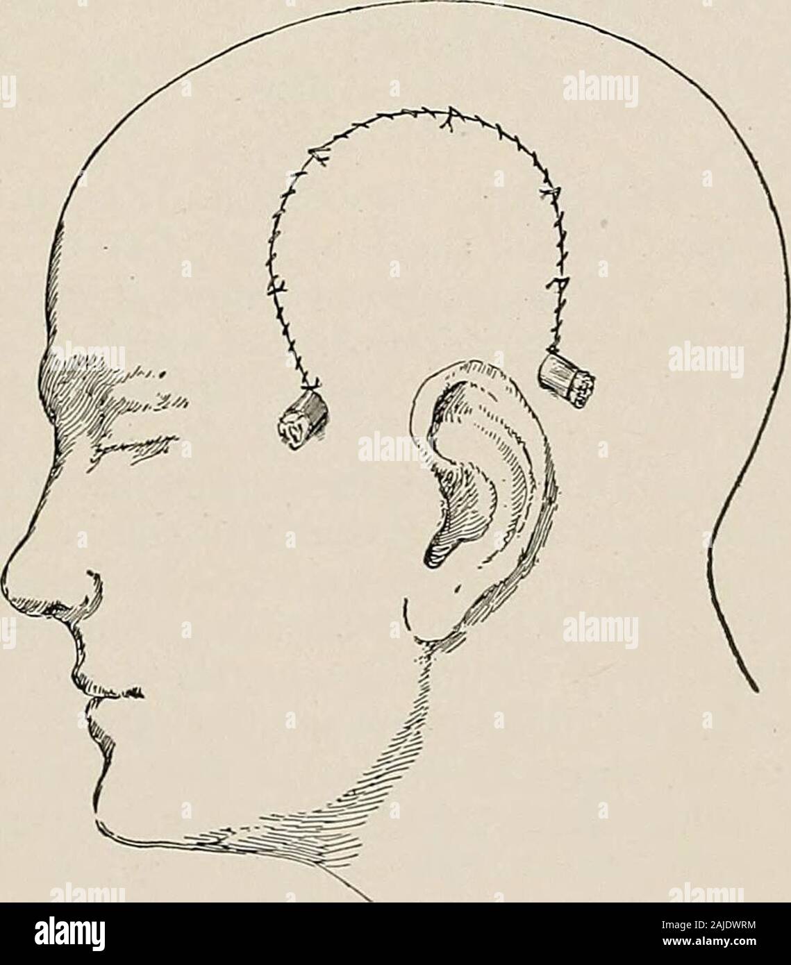 Surgical treatment; a practical treatise on the therapy of surgical ...