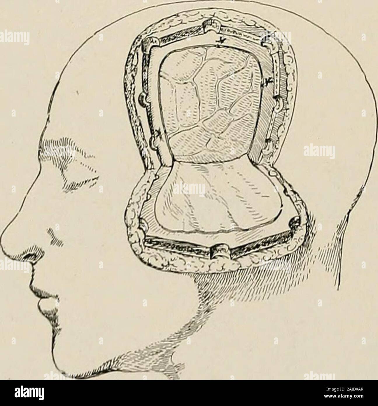 Surgical treatment; a practical treatise on the therapy of surgical ...