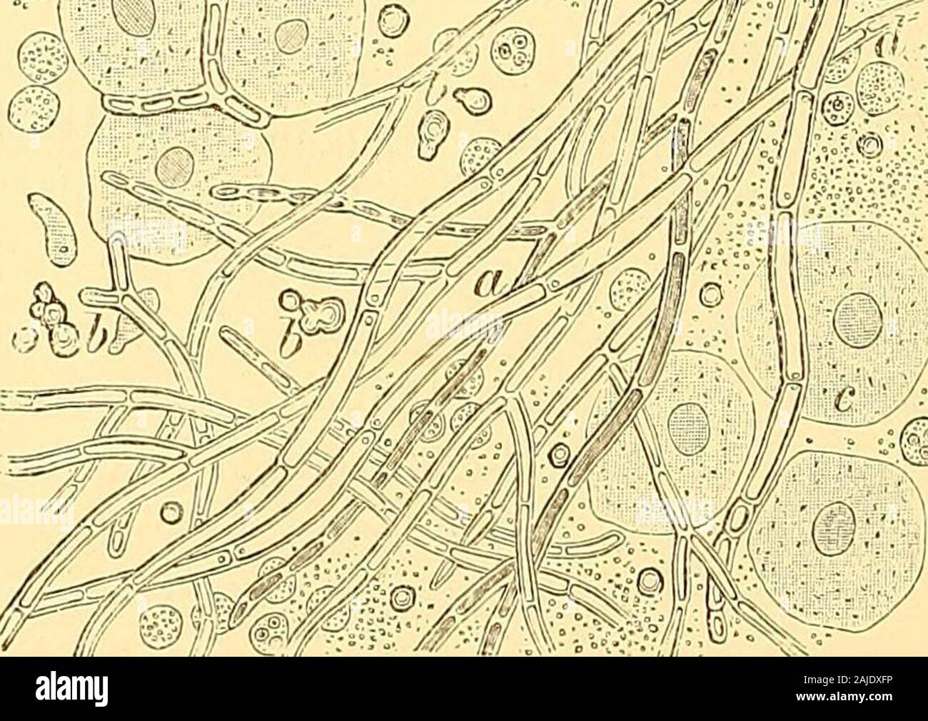 It figured strongly hi-res stock photography and images - Alamy