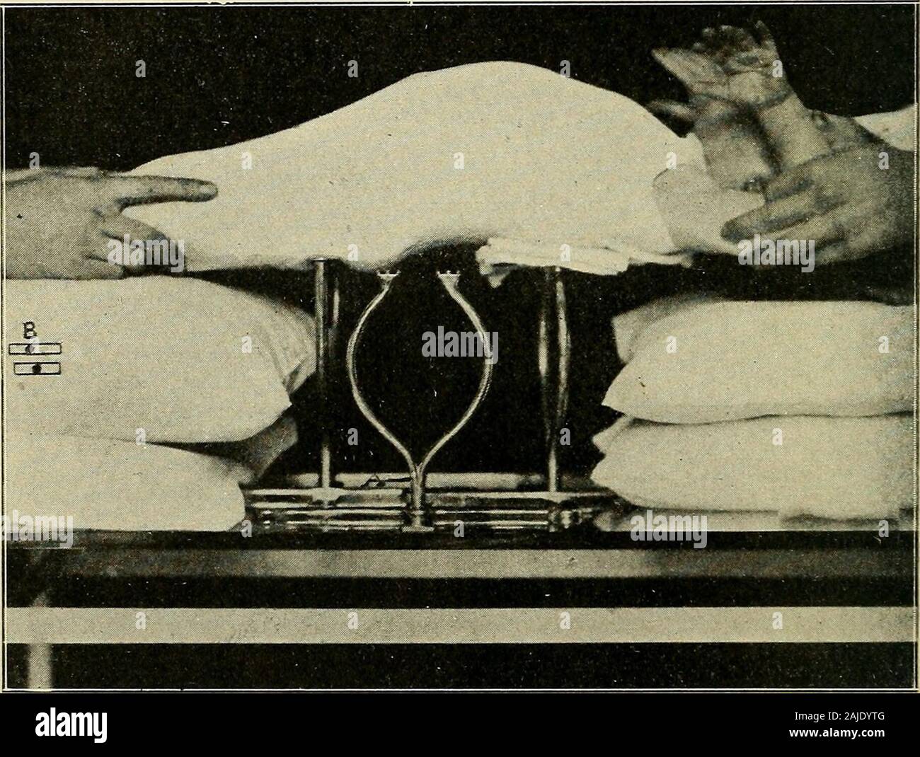 Plaster Jacket High Resolution Stock Photography and Images - Alamy