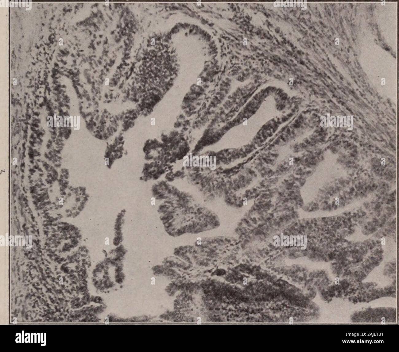 Myometrium Side View