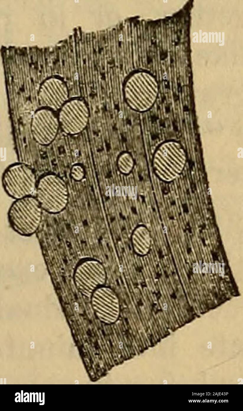 Fatty deposits hi-res stock photography and images - Alamy