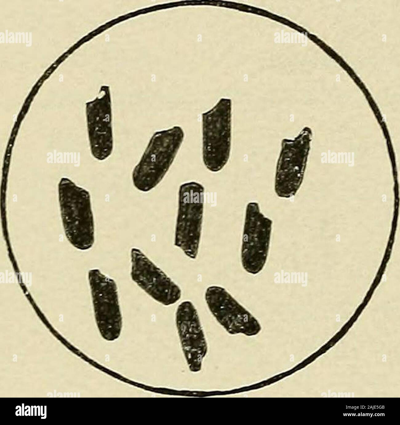 Deficiency diseases scurvy hi-res stock photography and images - Alamy