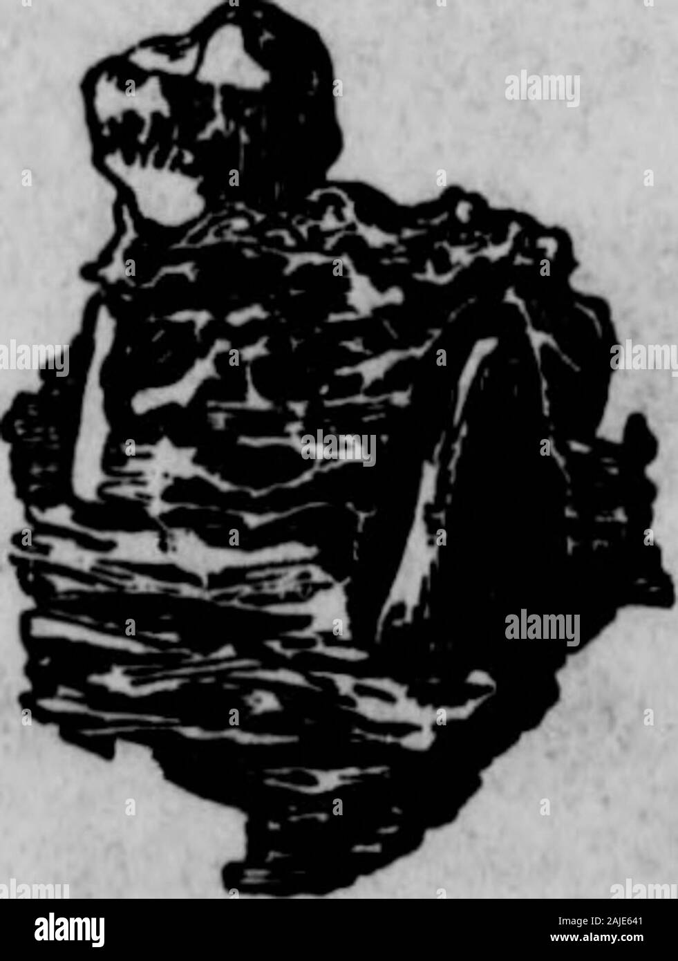 Alveolar abscess hi-res stock photography and images - Alamy