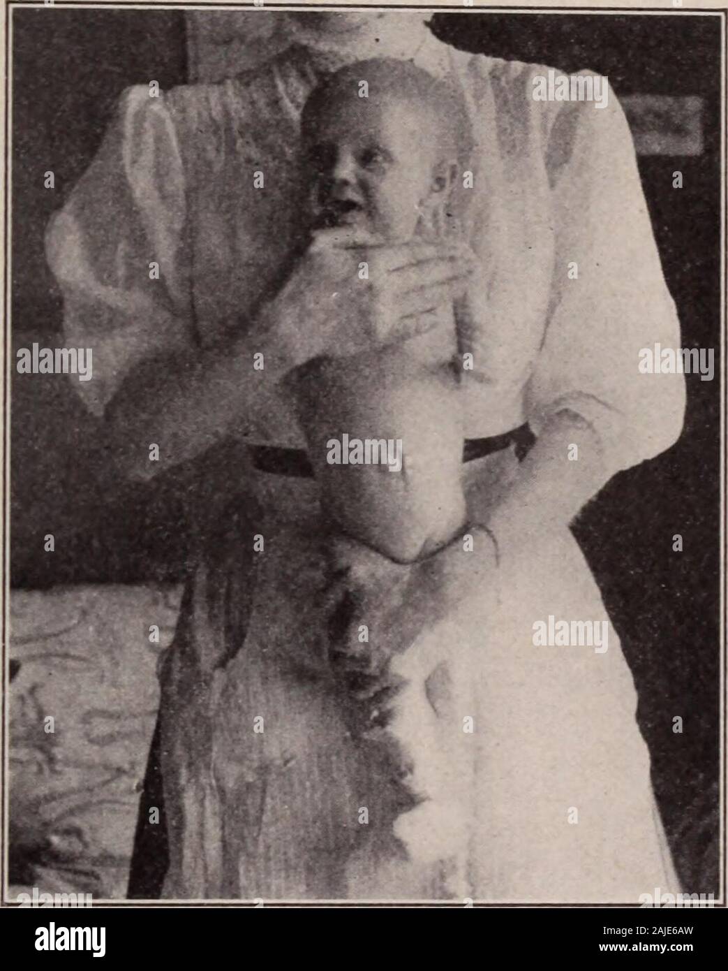 Peritoneal cavity fluid hi-res stock photography and images - Alamy