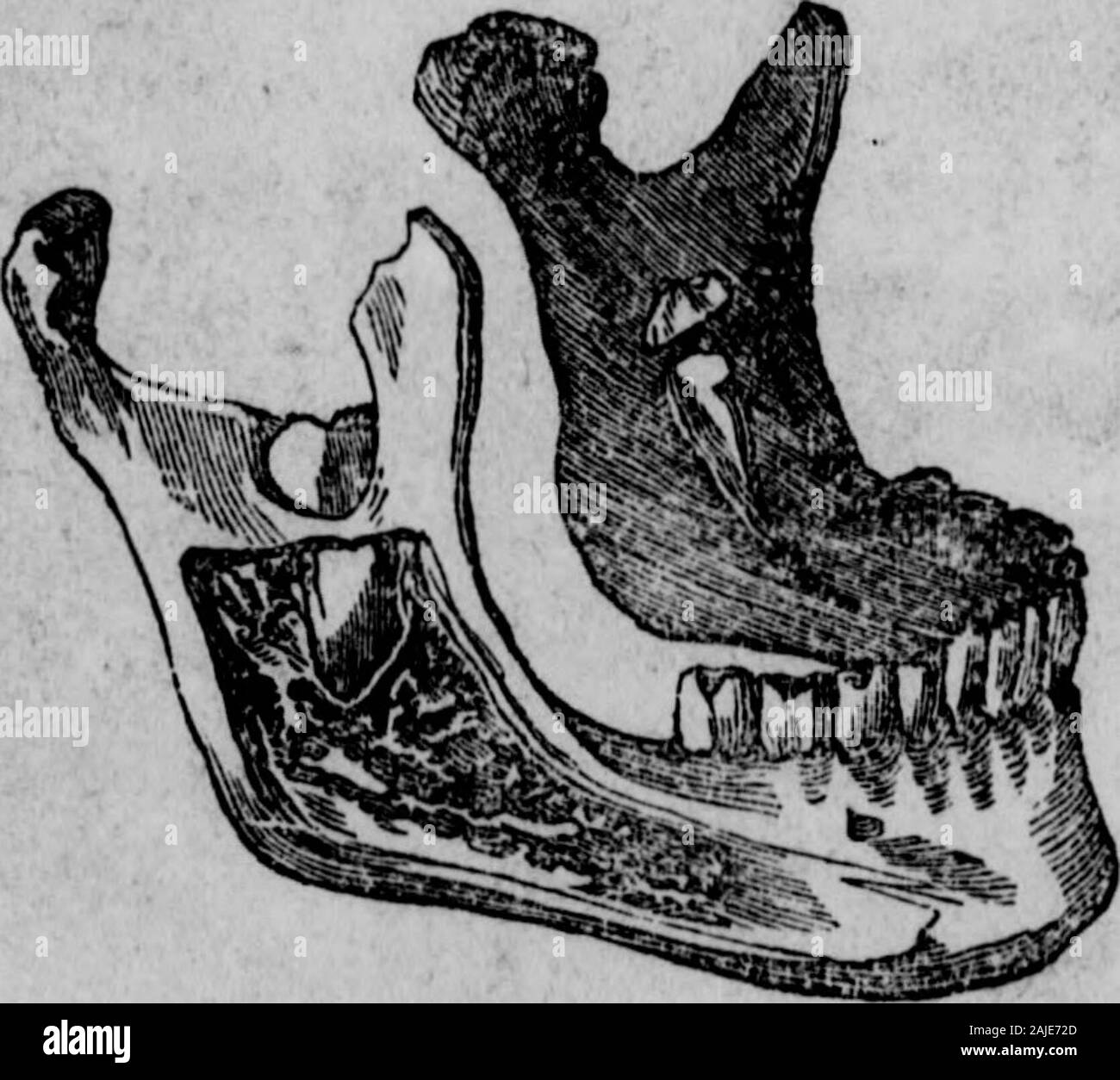 Anterior 13 Black and White Stock Photos & Images - Alamy