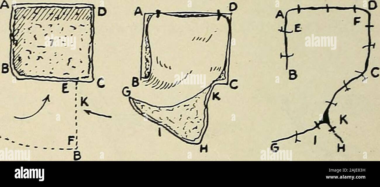 Plastic surgery; its principles and practice . H- H- Fig. 41 ...