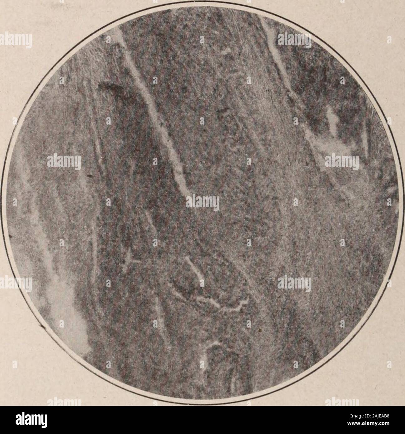 Sectioned kidney hi-res stock photography and images - Alamy