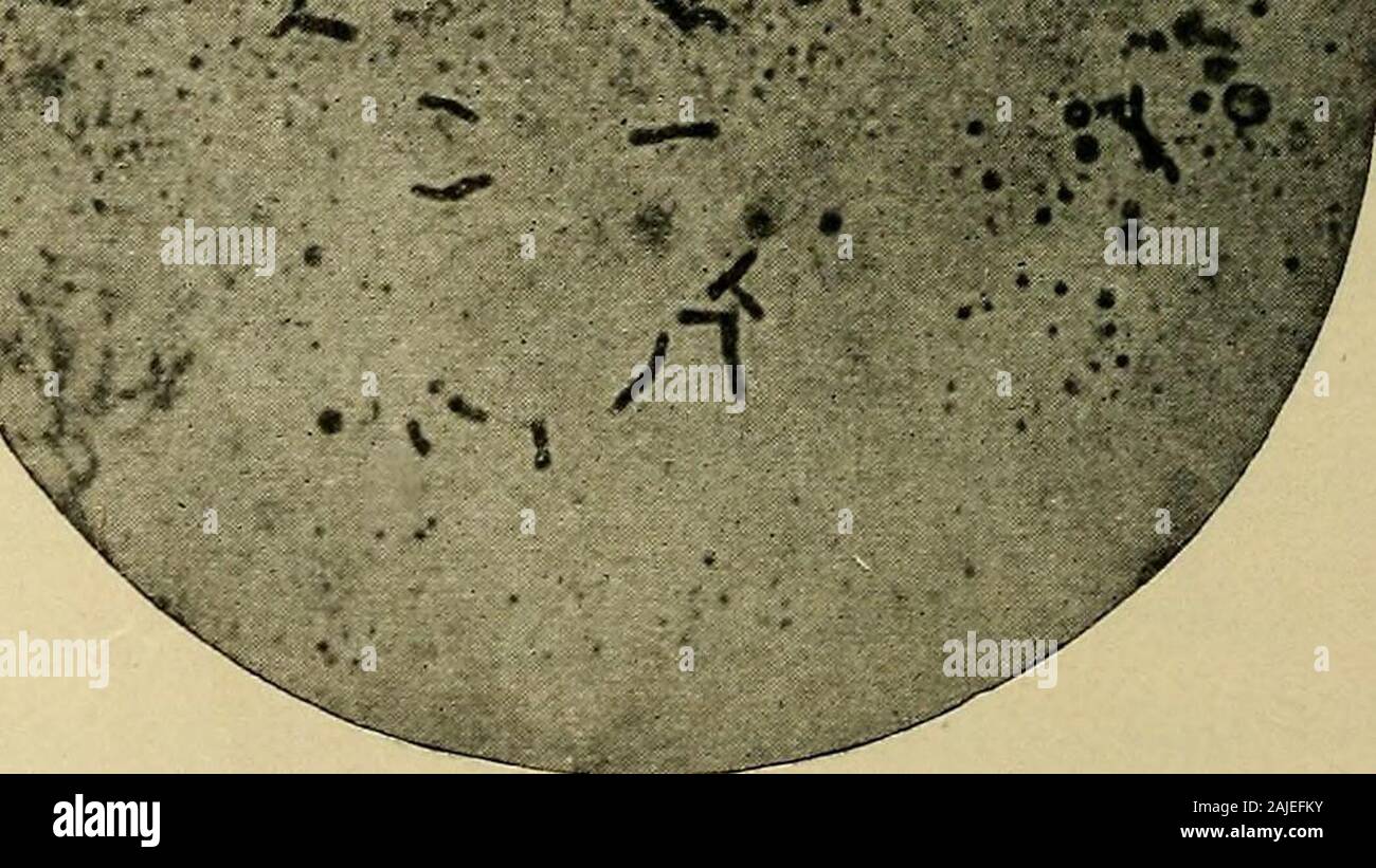 Bacterial Spores Under Microscope