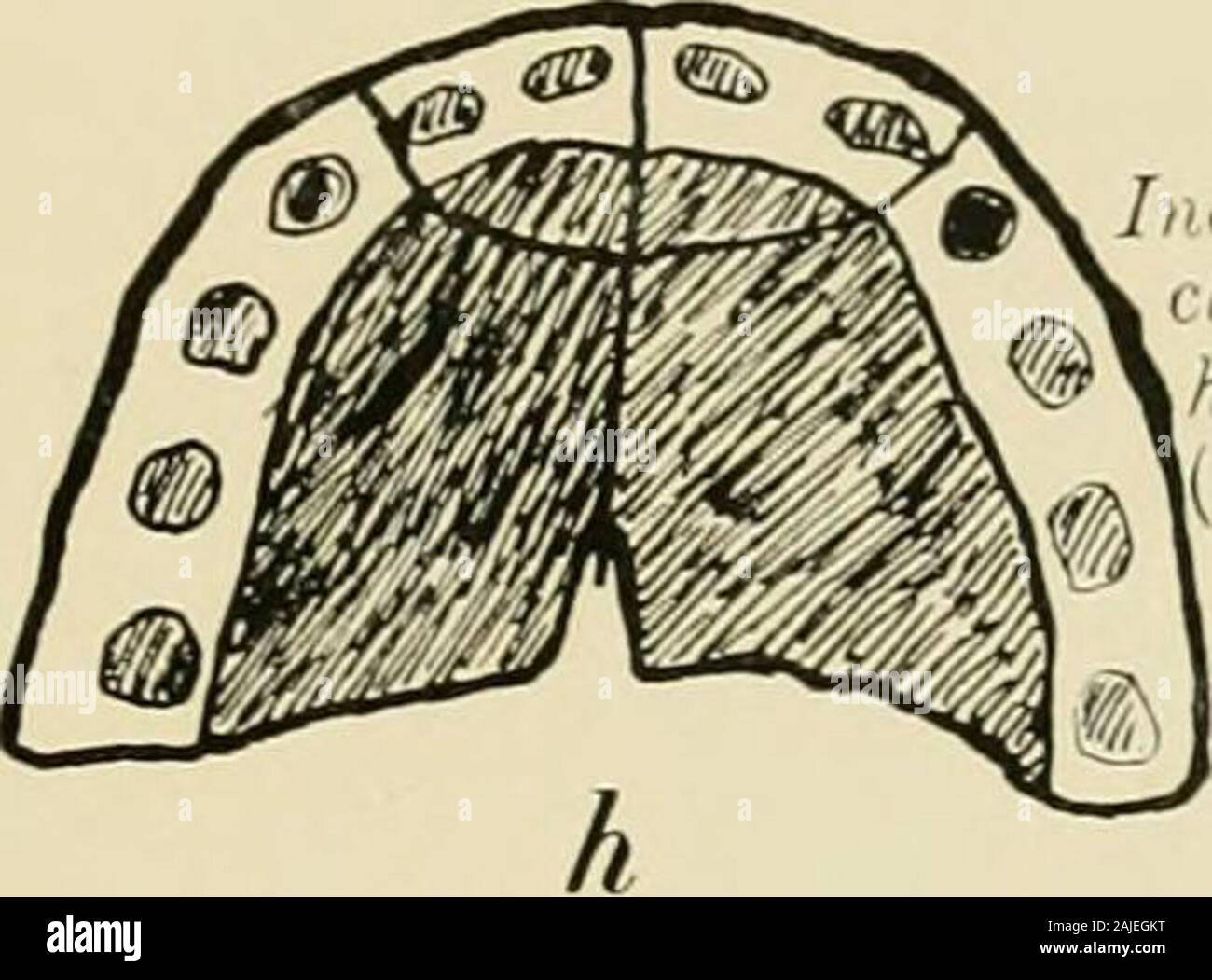 Treasury of human inheritance . Cleft of alcfulus(Kieferspatte Fronto ...