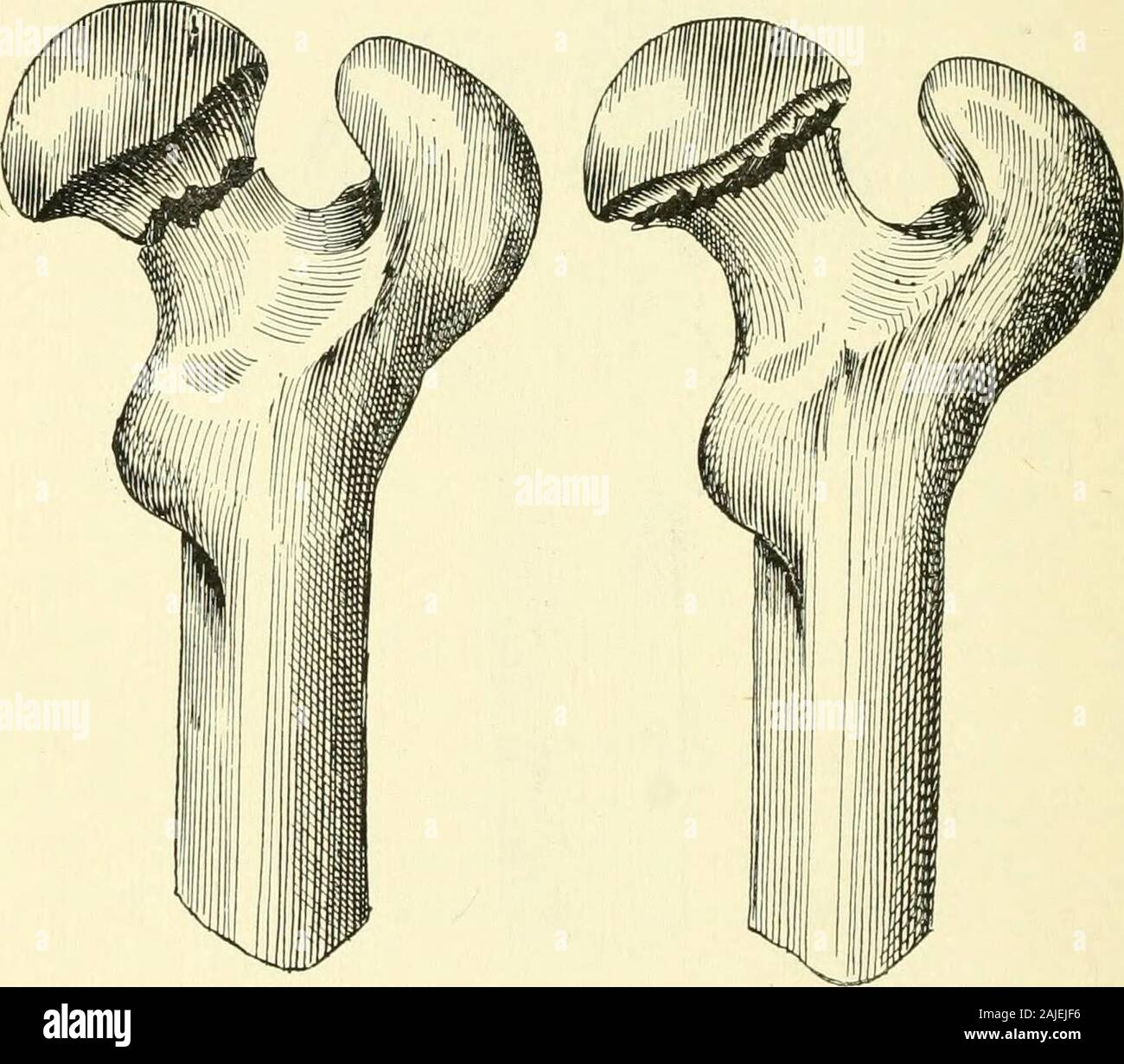 The treatment of fractures . d the capsular enclosed portion of the ...