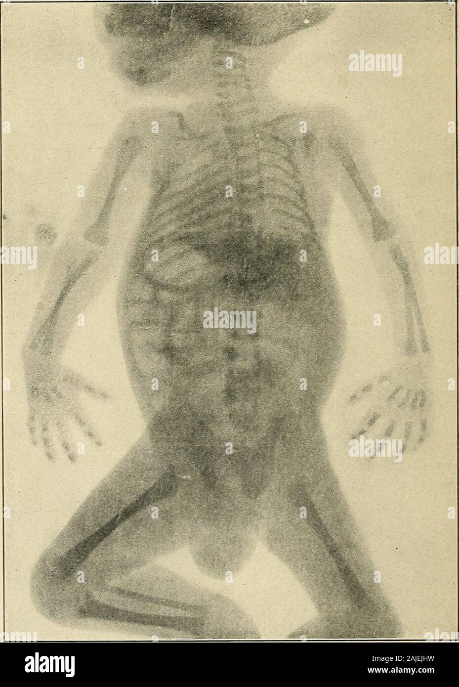 Baby grow made hi-res stock photography and images - Alamy