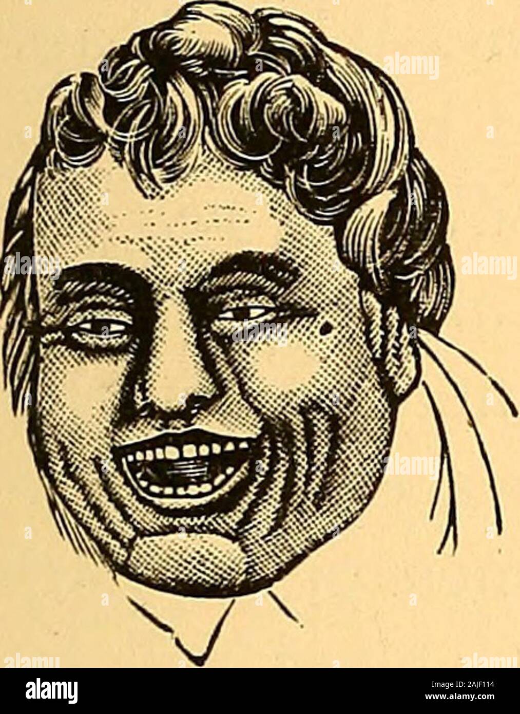 Ruddy complexion hi-res stock photography and images - Alamy