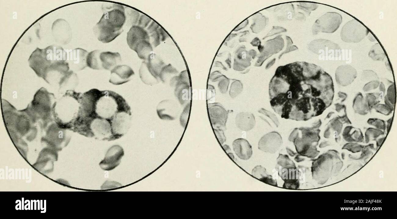 Packed red cells hi-res stock photography and images - Alamy