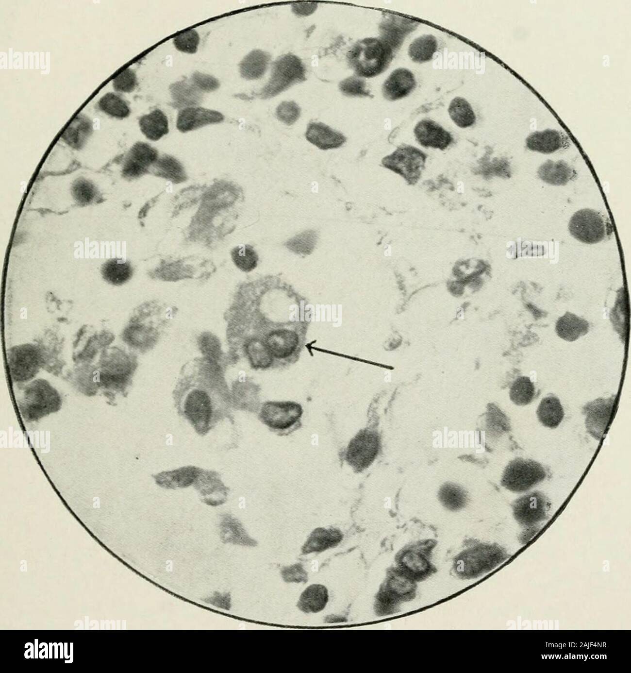 Medical and surgical reports . he phagocytic leucocytes and others ...