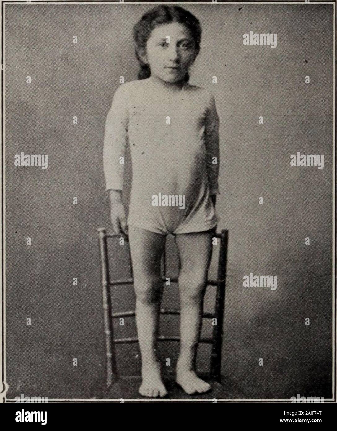 Malleoli hi-res stock photography and images - Alamy