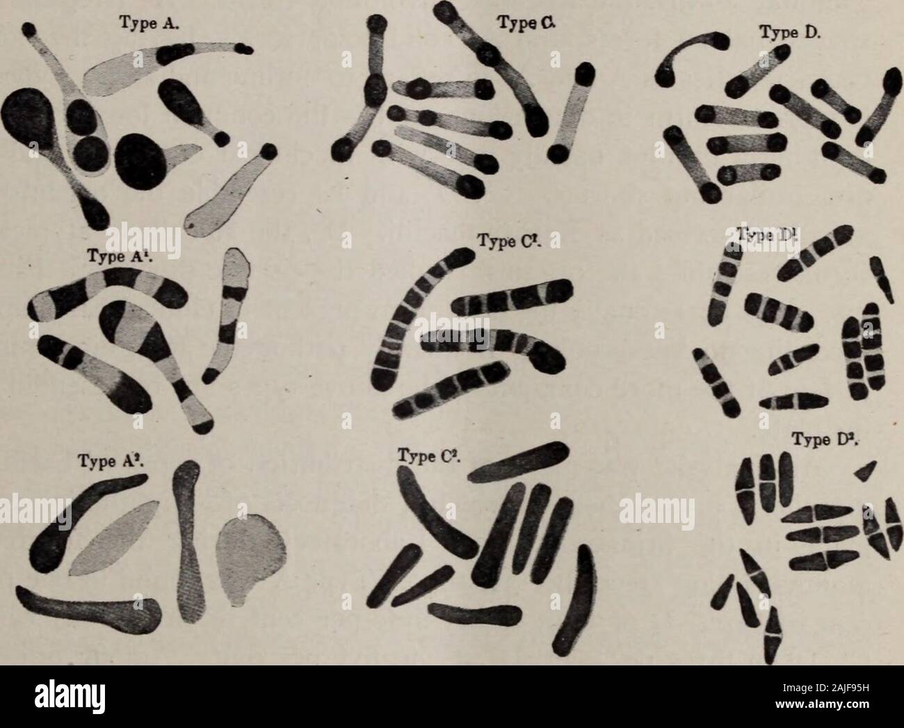 Diphtheria throat hi-res stock photography and images - Alamy
