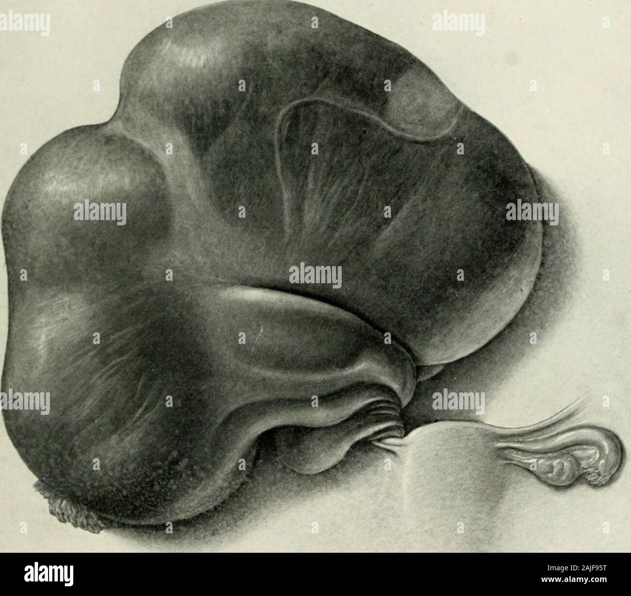 Medical and surgical reports . e mass, but slightly movable ...