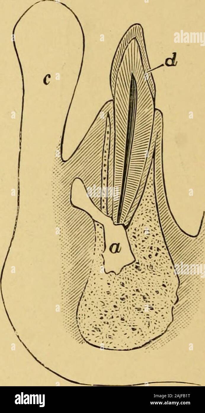 Acute dental abscess hi-res stock photography and images - Alamy