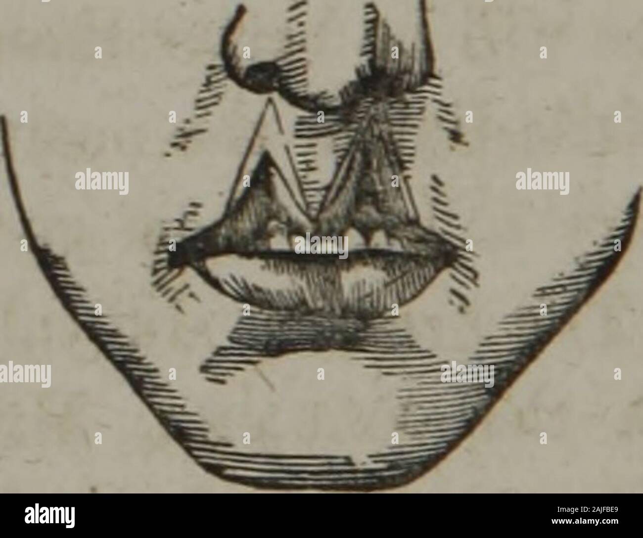 Lip and palate fissure surgery hi-res stock photography and images - Alamy