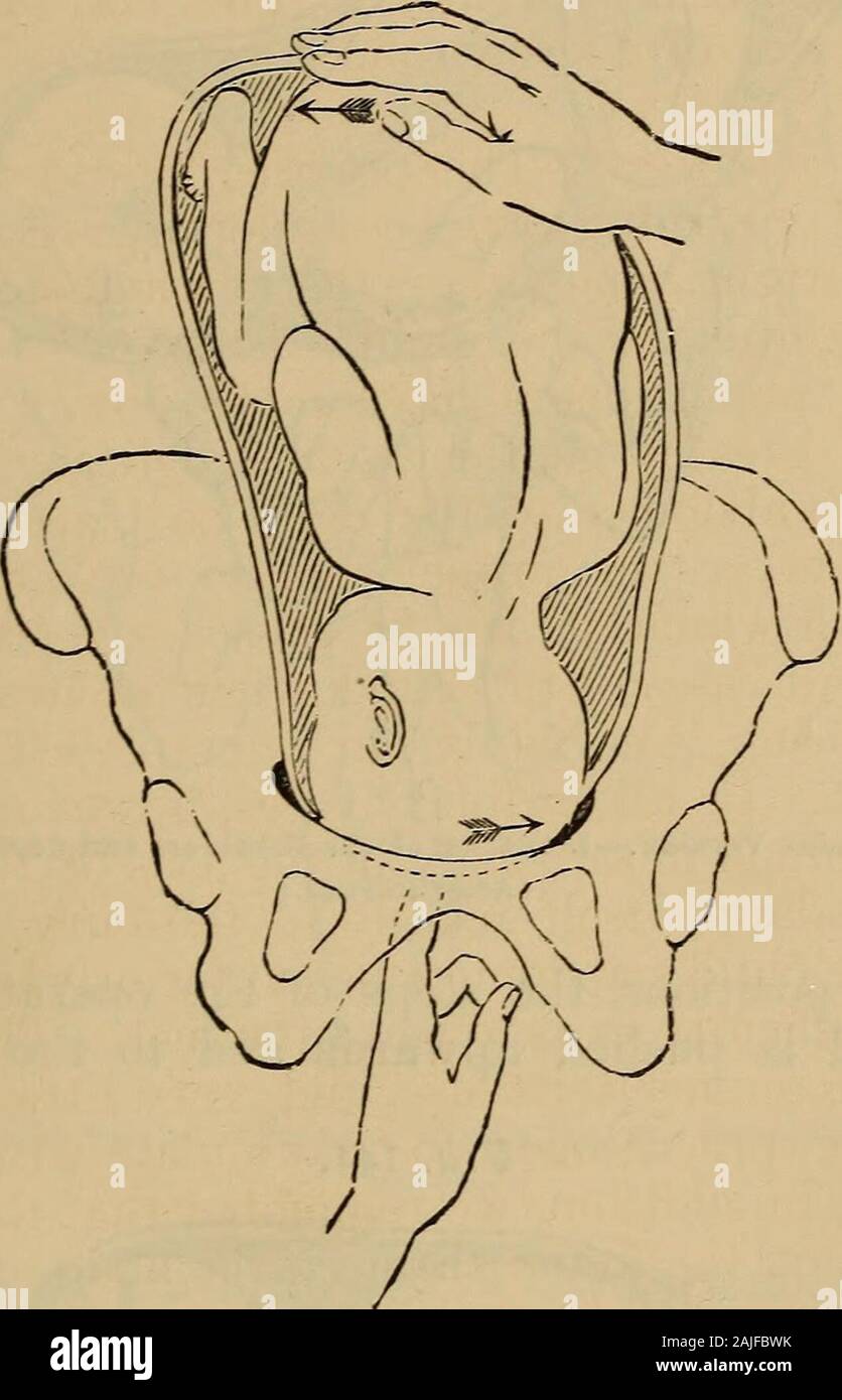 Podalic version hi-res stock photography and images - Alamy