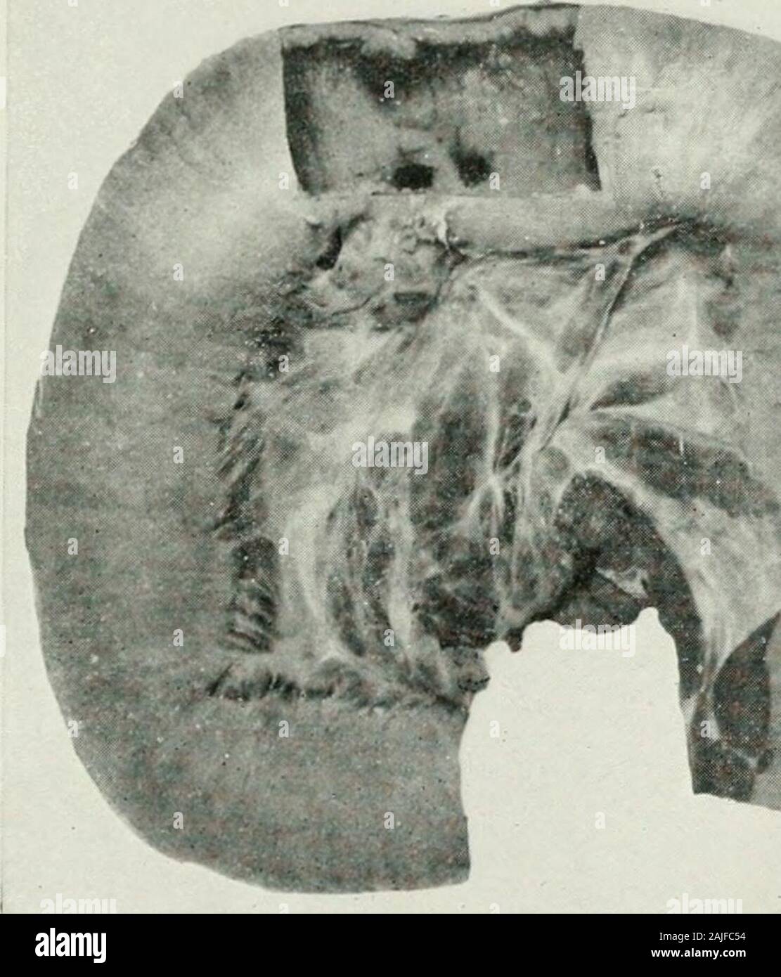 Medical and surgical reports . Ti^^H Fig. 4.—Interior view of the ...