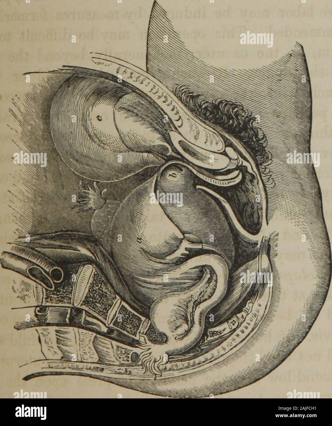 Fundus of uterus hi-res stock photography and images - Alamy