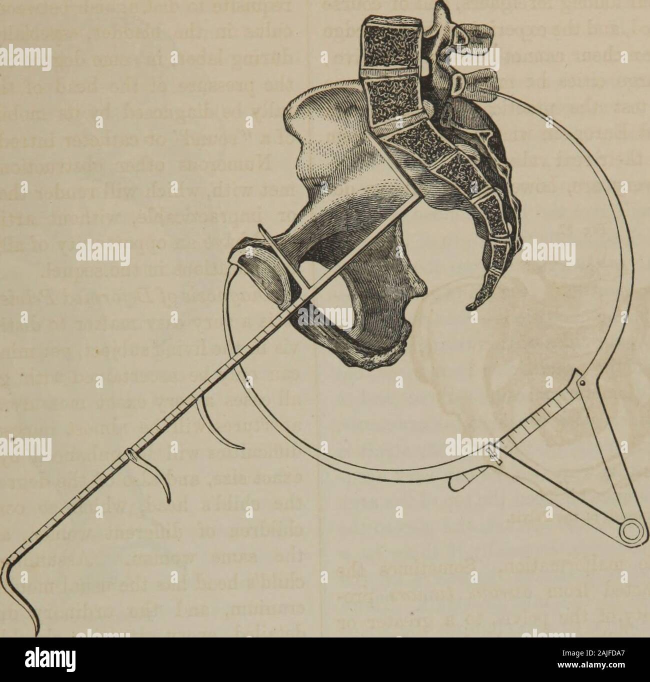 The principles and practice of obstetrics . m the anterior face of the ...