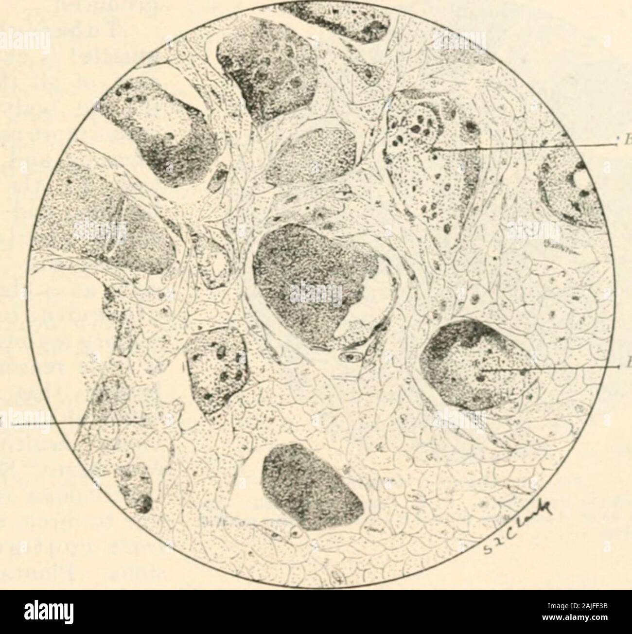 Manual of pathology : including bacteriology, the technic of ...