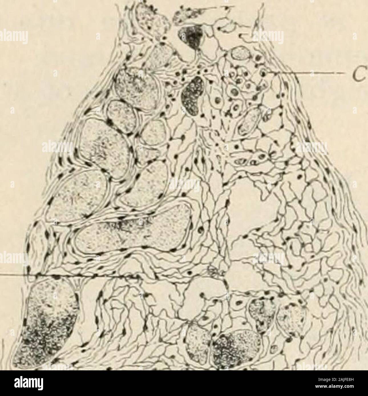 Pneumococci hi-res stock photography and images - Alamy