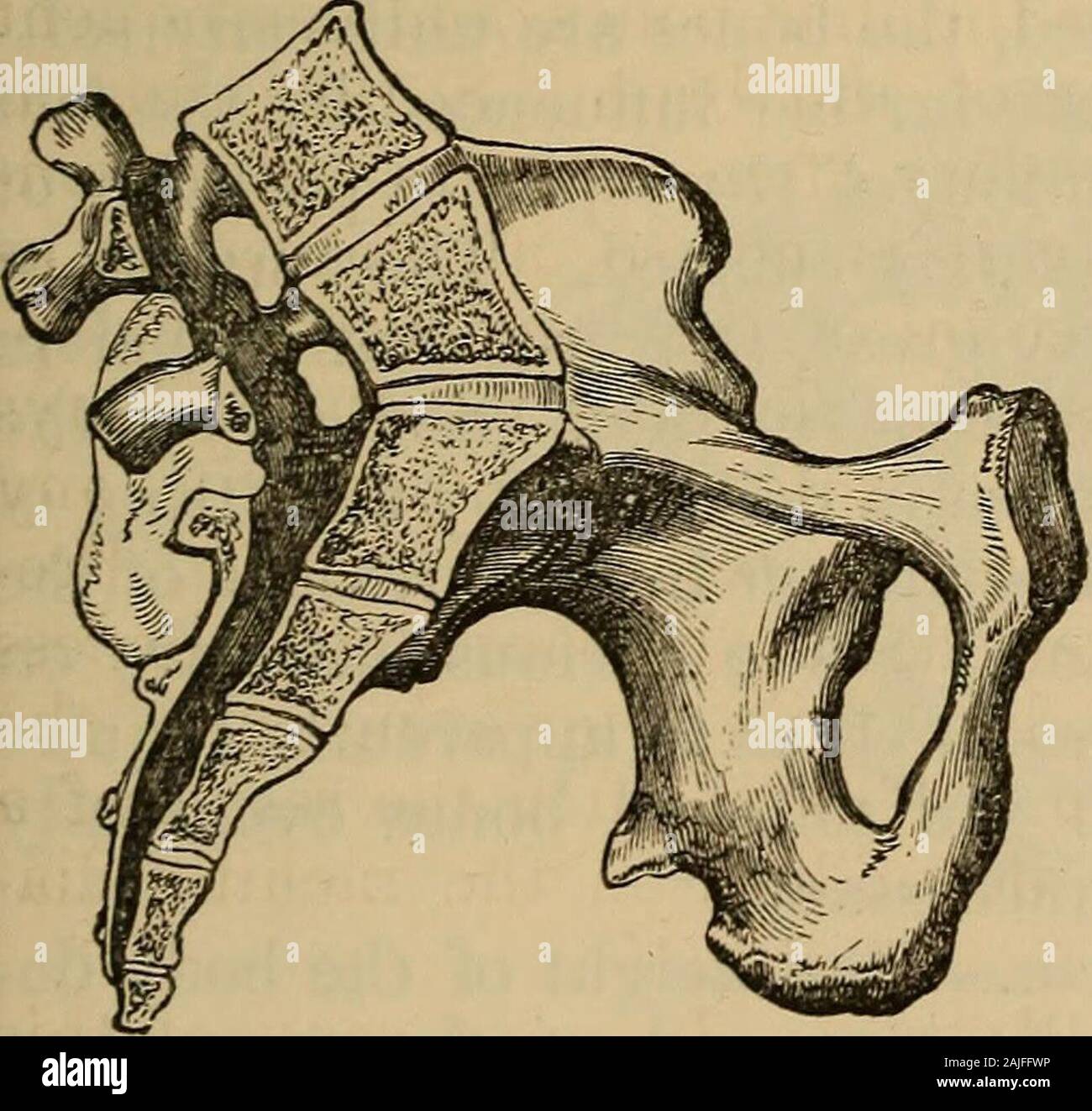 A treatise on the science and practice of midwifery . Rickety Pelvis ...
