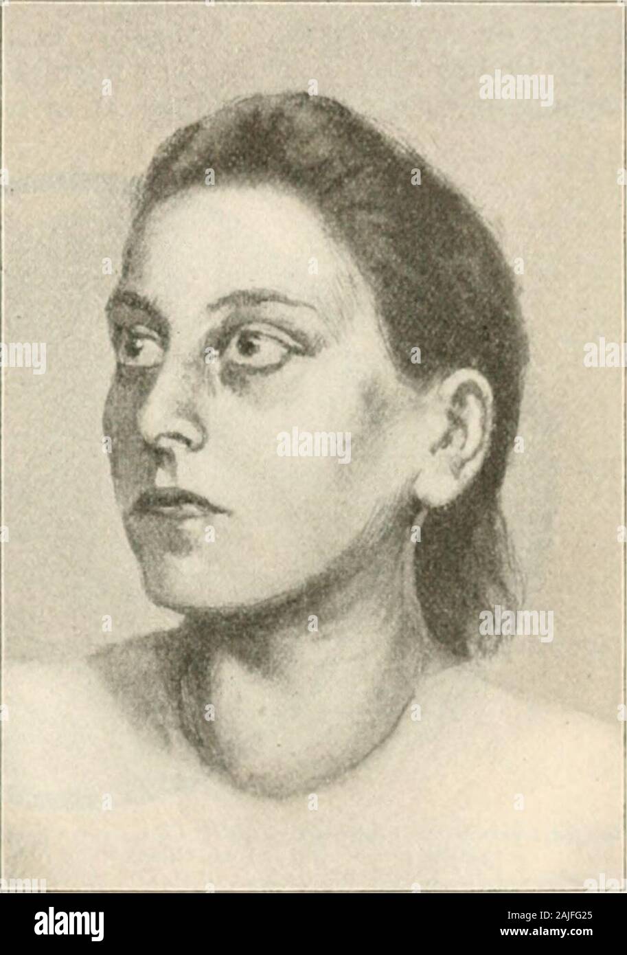 Osteomata hi-res stock photography and images - Alamy