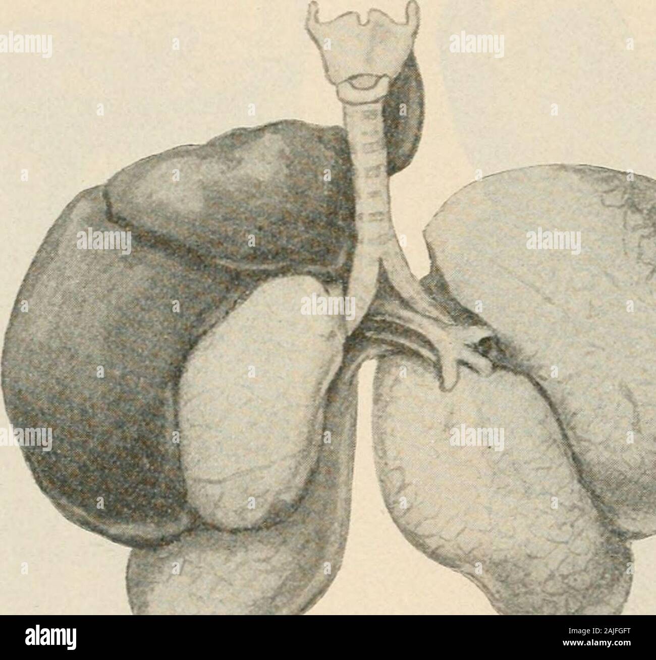 Manual of pathology : including bacteriology, the technic of ...