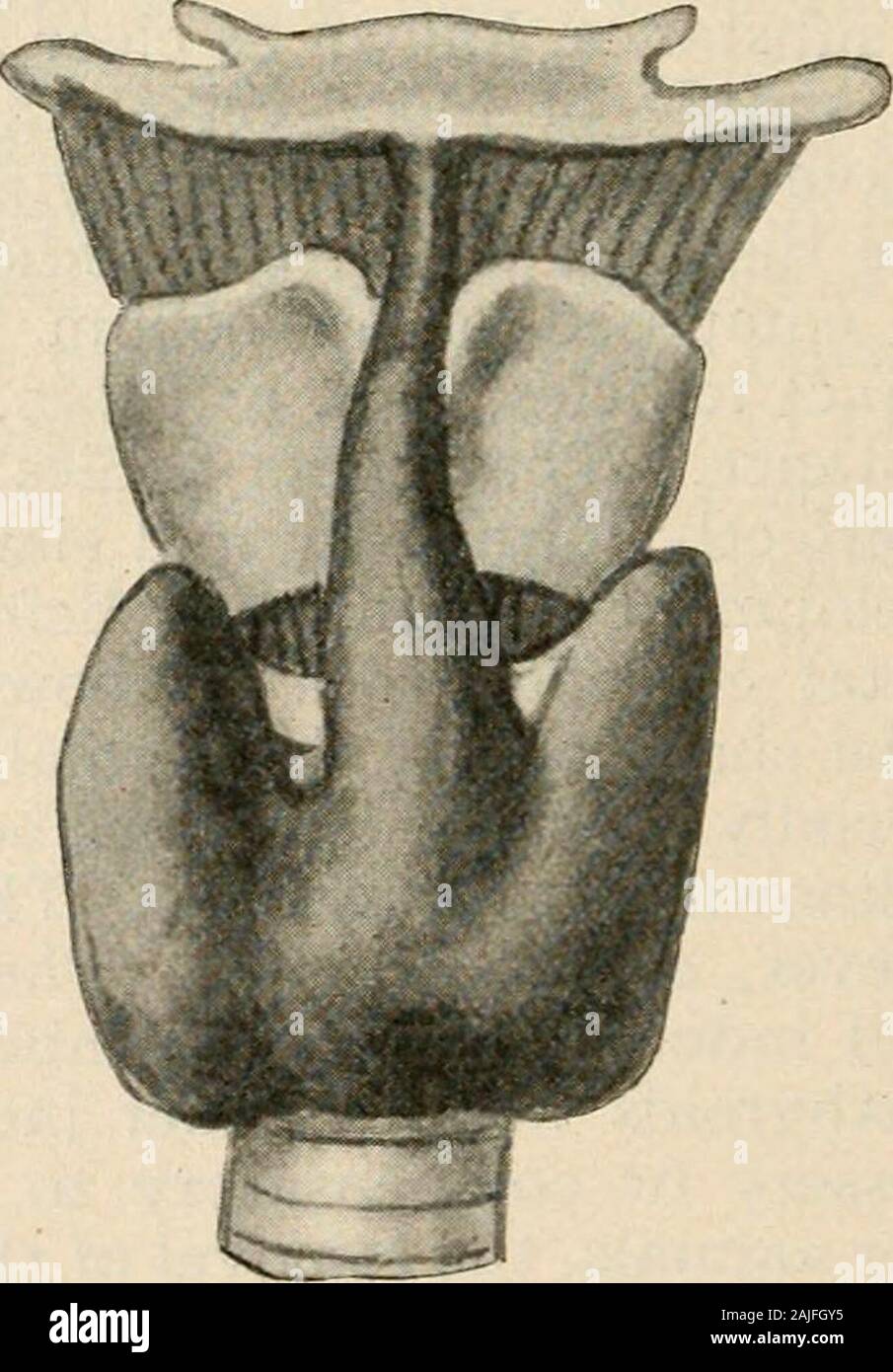 Pyramidal lobe of thyroid hi-res stock photography and images - Alamy