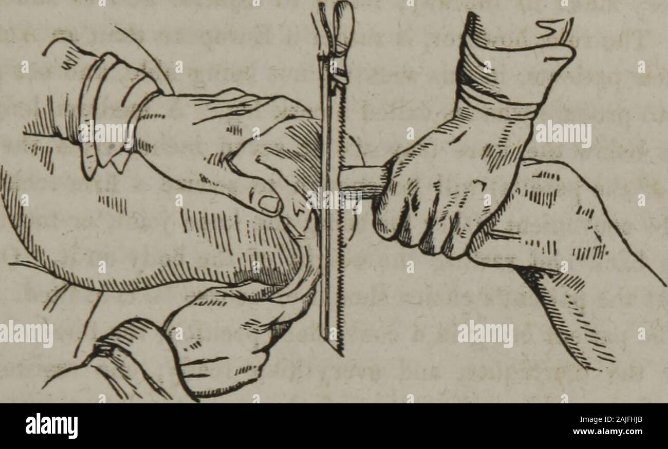 The homeopathic practice of surgery : together with operative surgery ...