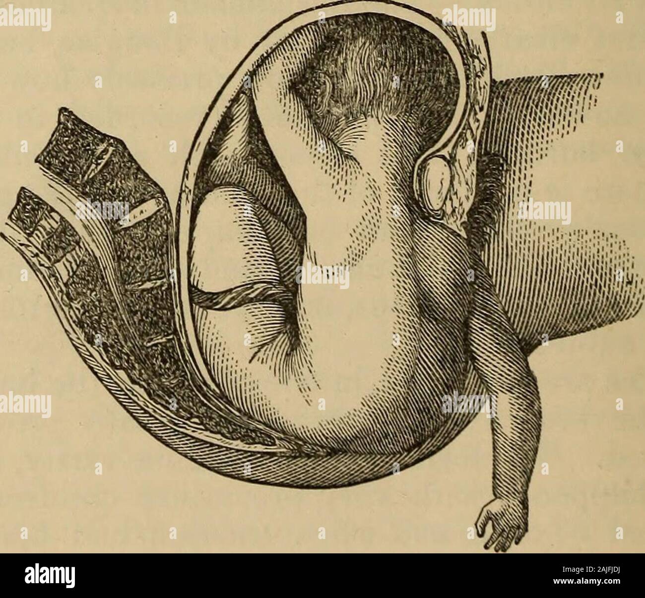 A treatise on the science and practice of midwifery . Commencing ...