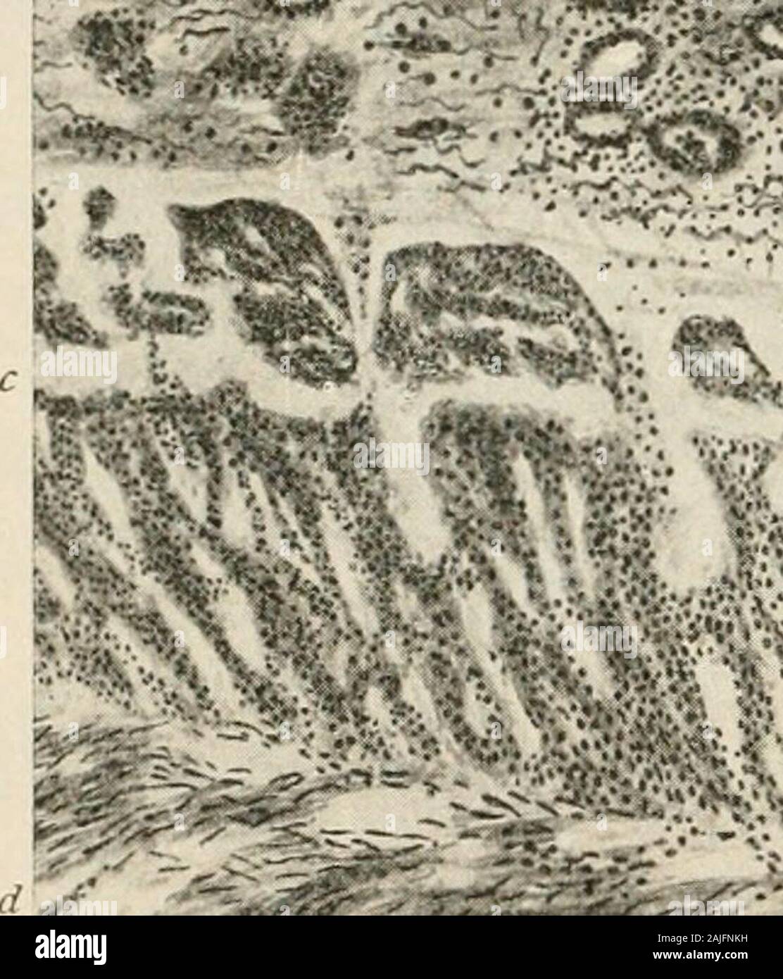 Manual of pathology : including bacteriology, the technic of ...