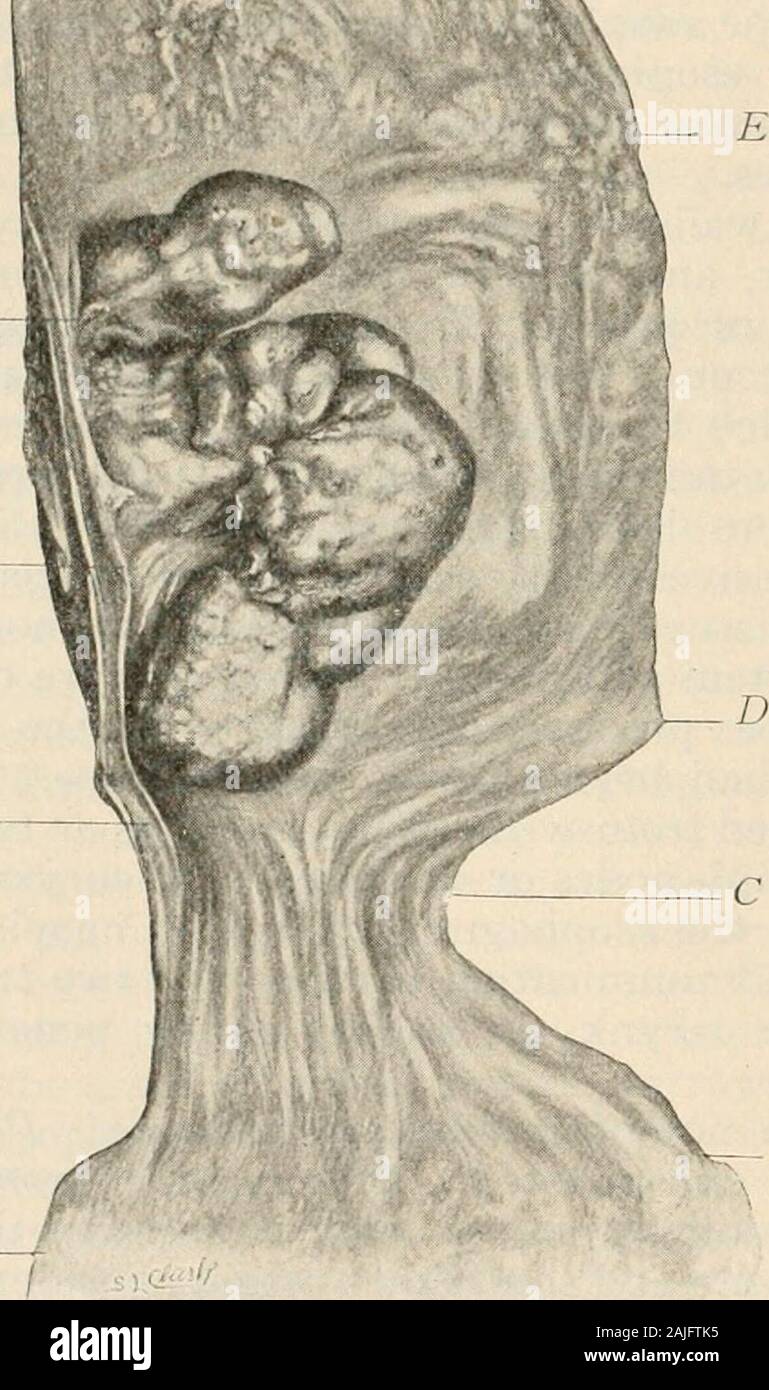 Manual of pathology : including bacteriology, the technic of ...