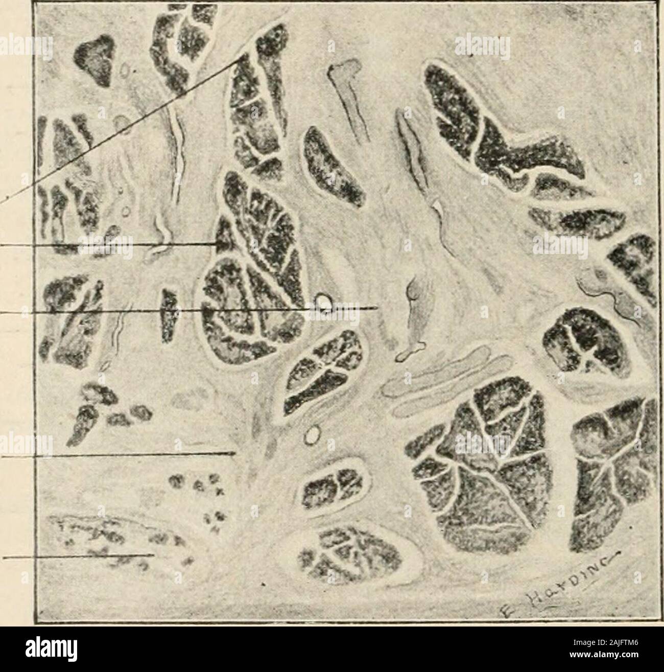 Manual of pathology : including bacteriology, the technic of ...